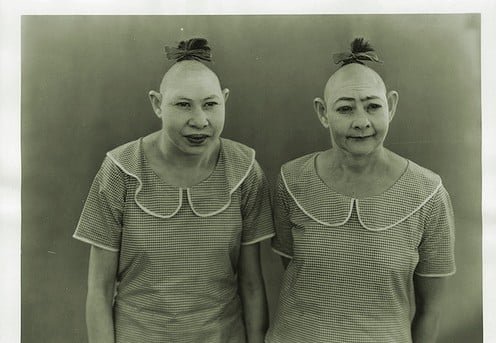 Show de horrores: 10 pessoas com anomalias que viraram atrações de ...